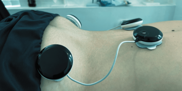 EMS (Electrical Muscle Stimulation) therapy - St Giles Physiotherapy ...
